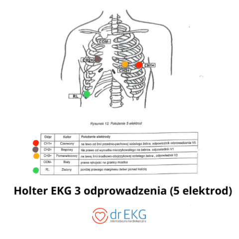 Holter EKG Rozmieszczenie Elektrod 3-odprowadzenia (5 Elektrod) Holter ...